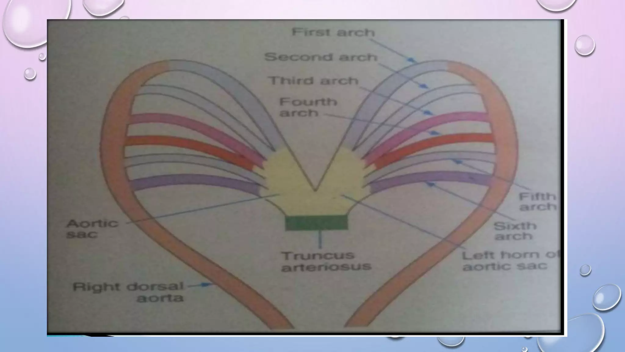 Aortic arch anomalies | PPTX | Heart and Cardiovascular Diseases ...