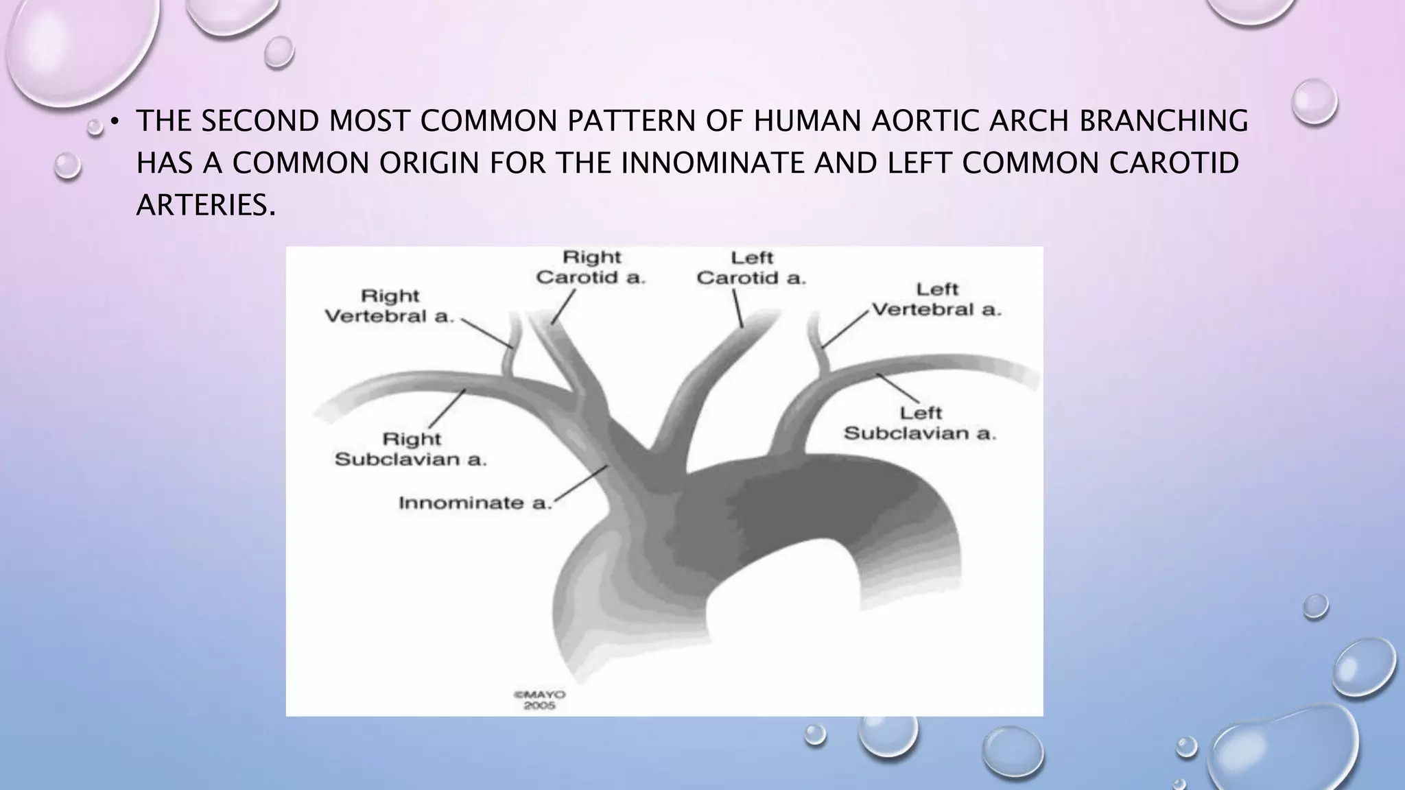 Aortic arch anomalies | PPTX | Heart and Cardiovascular Diseases ...