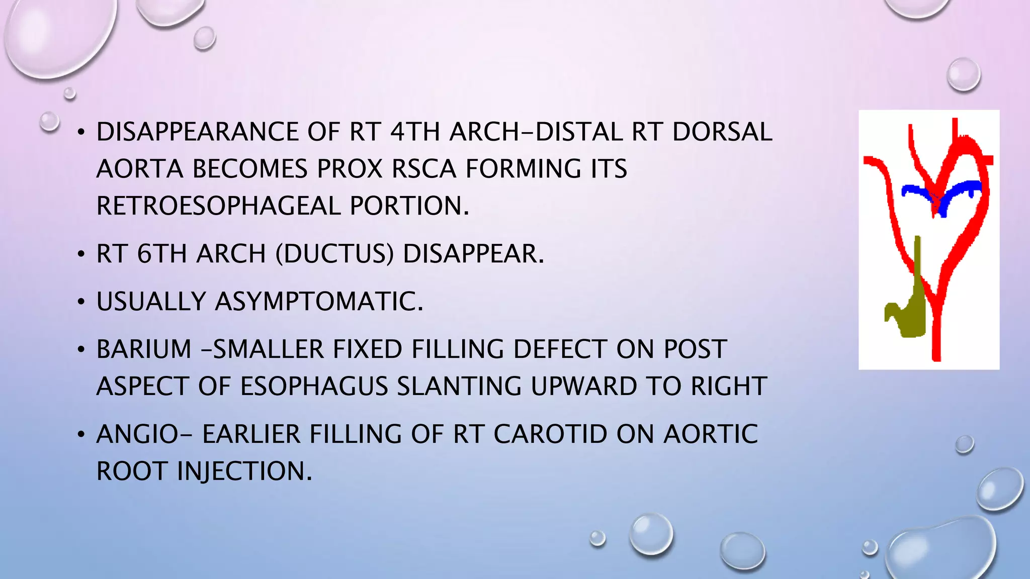Aortic arch anomalies | PPTX | Heart and Cardiovascular Diseases ...