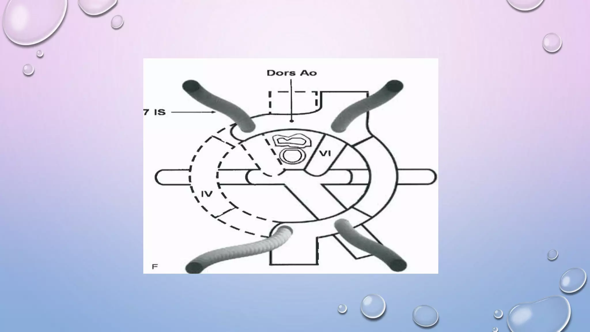 Aortic arch anomalies | PPTX | Heart and Cardiovascular Diseases ...