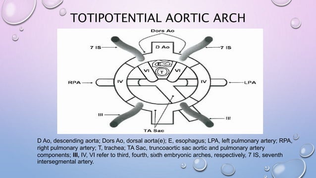 Aortic arch anomalies | PPTX | Heart and Cardiovascular Diseases ...