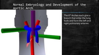 Aortic arch anomalies | PPTX