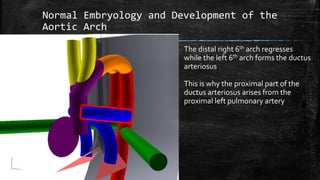 Aortic arch anomalies | PPTX