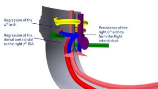 Aortic arch anomalies | PPTX