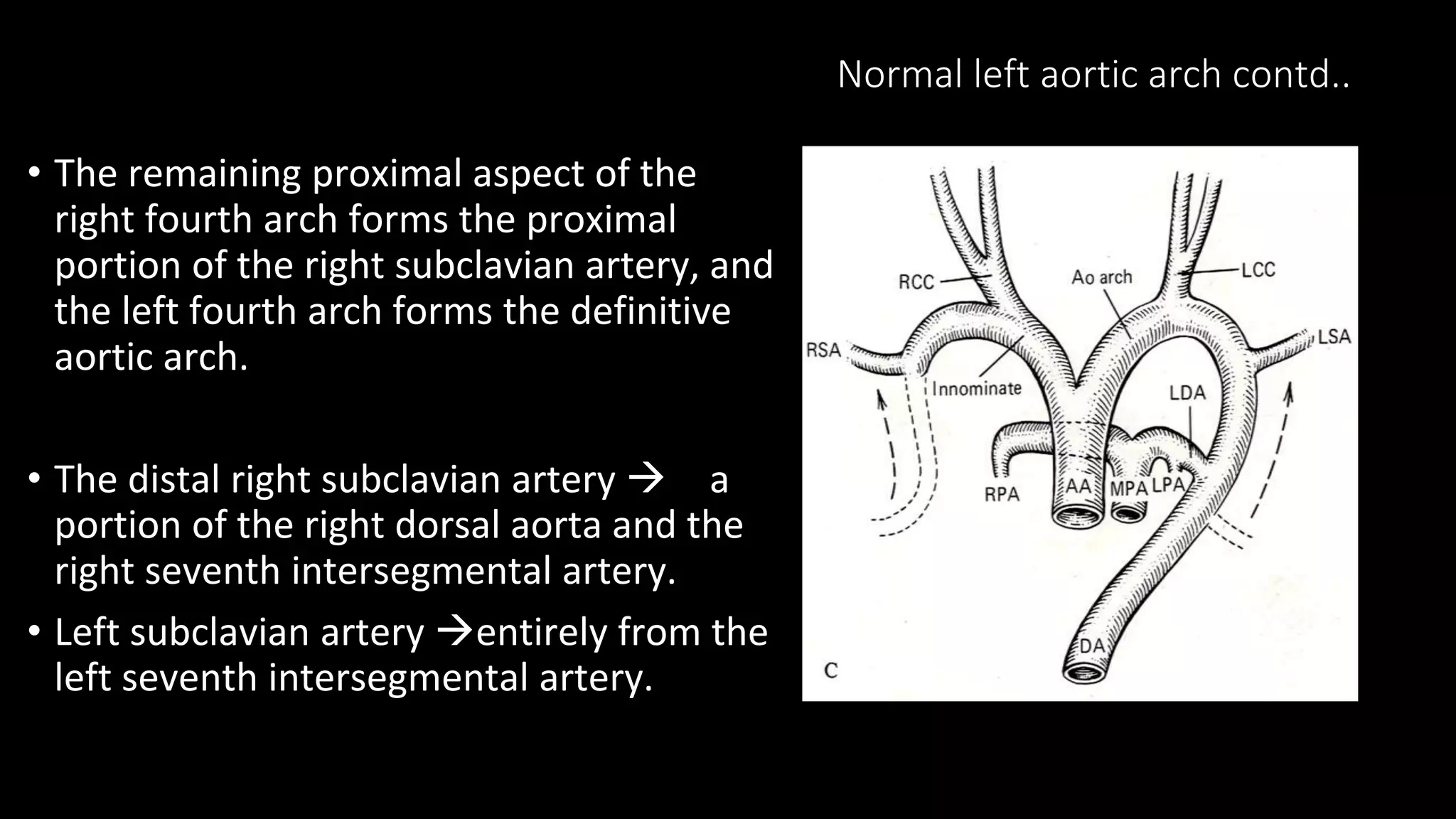 AORTIC ARCH ANOMALIES 2.pptx