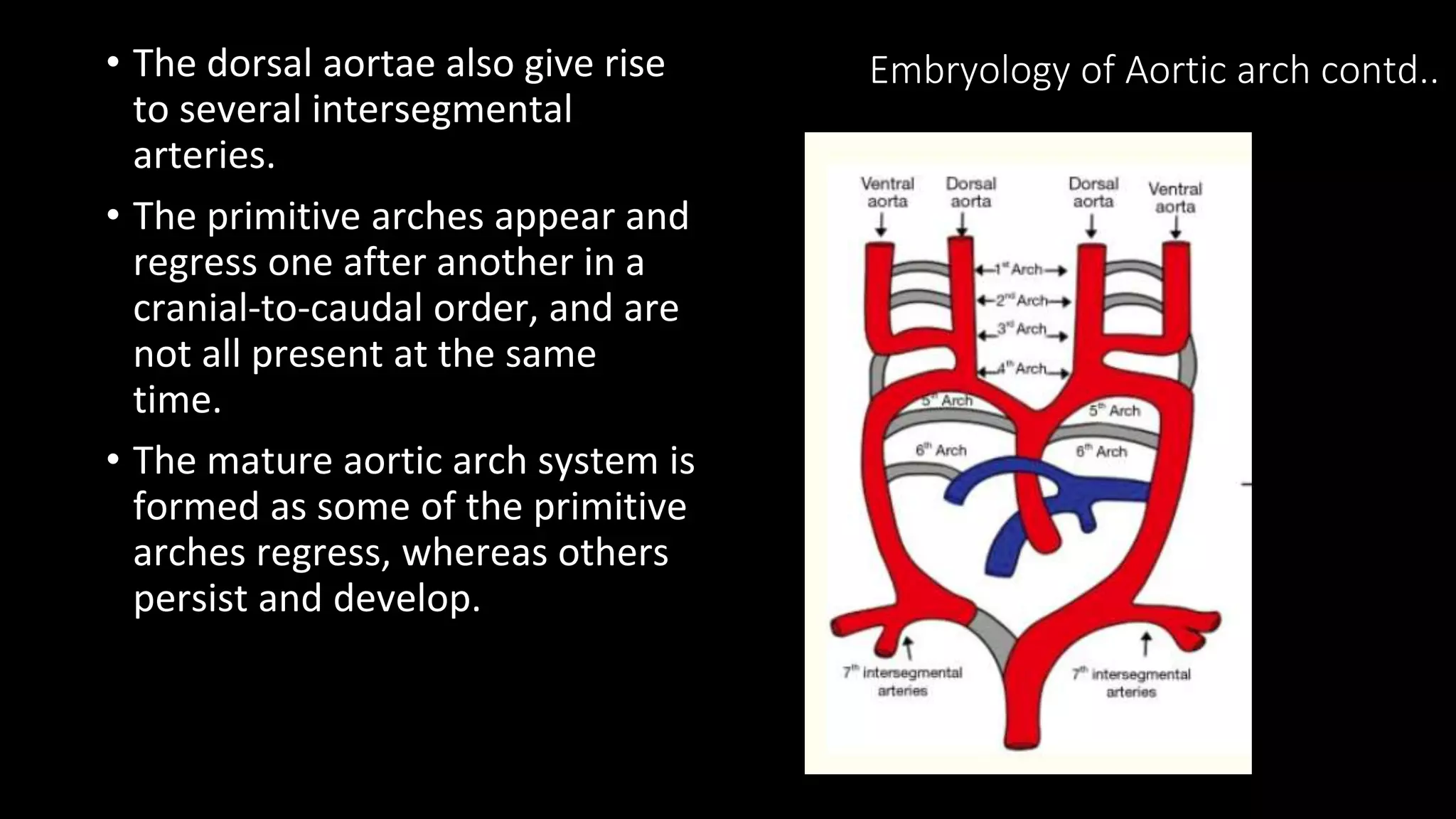 AORTIC ARCH ANOMALIES 2.pptx
