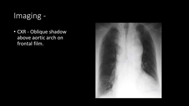 AORTIC ARCH ANOMALIES 2.pptx | Heart and Cardiovascular Diseases ...