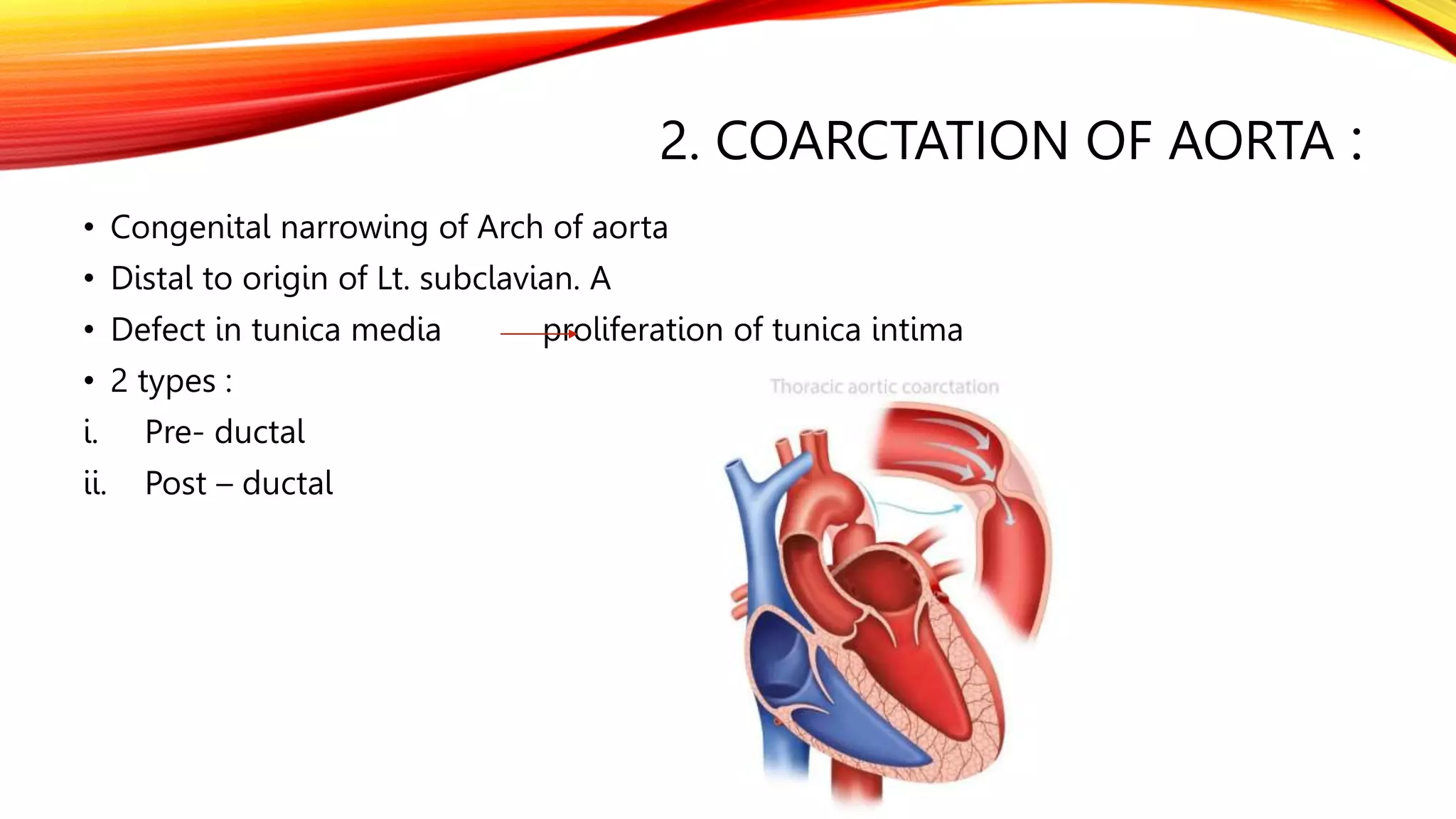 Aortic arches.pptx