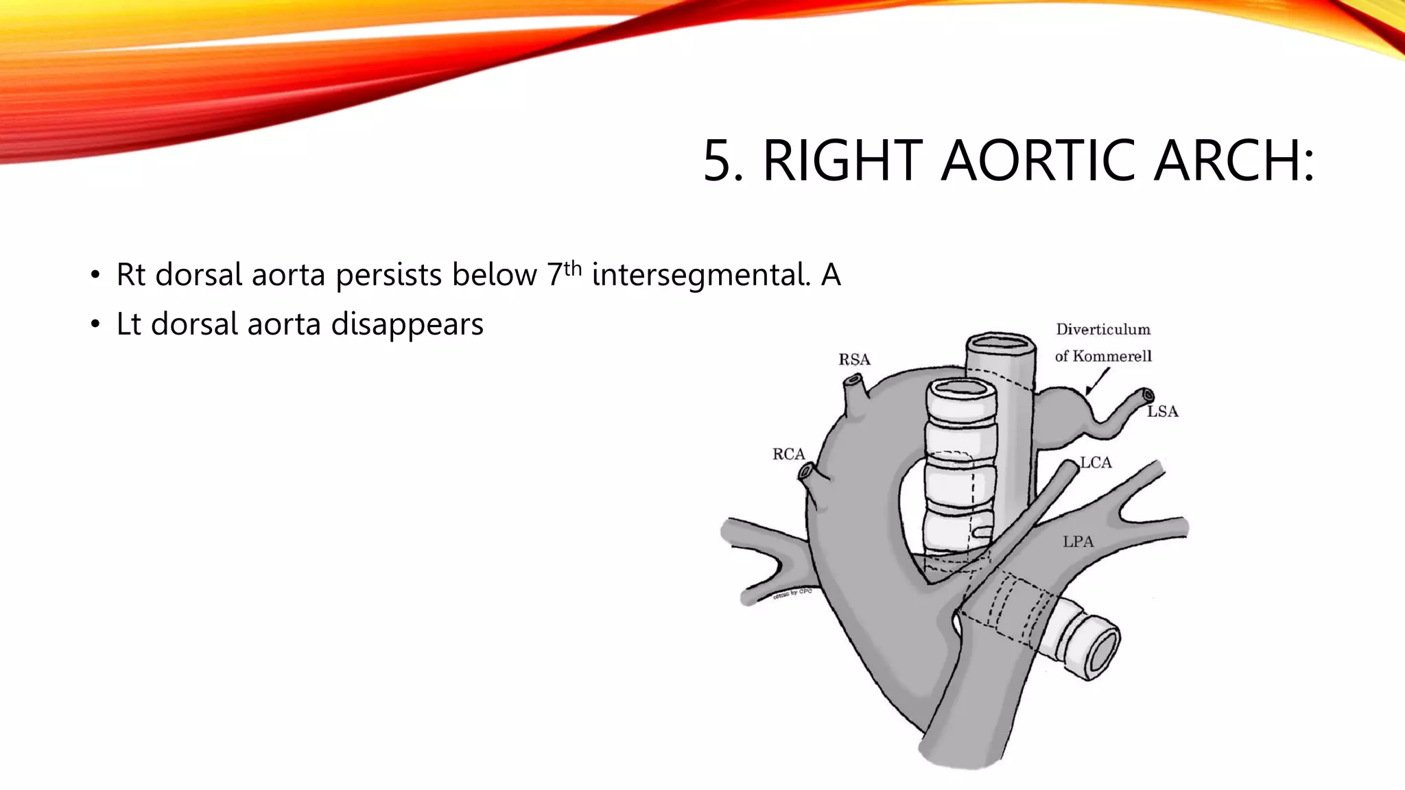 Aortic arches.pptx