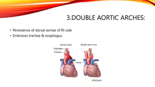 Aortic arches.pptx