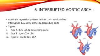 Aortic arches.pptx