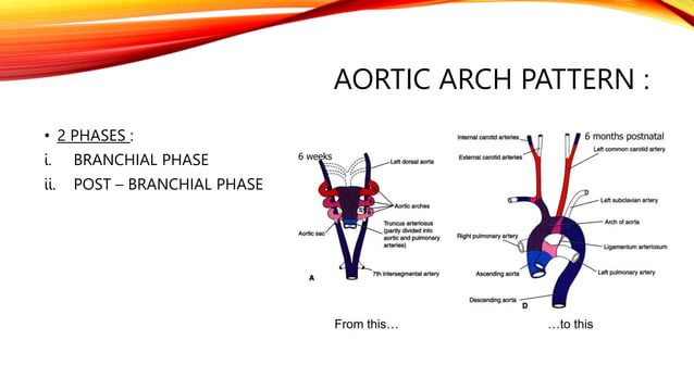 Aortic arches.pptx
