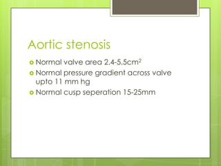 Aortic diseases | PPTX
