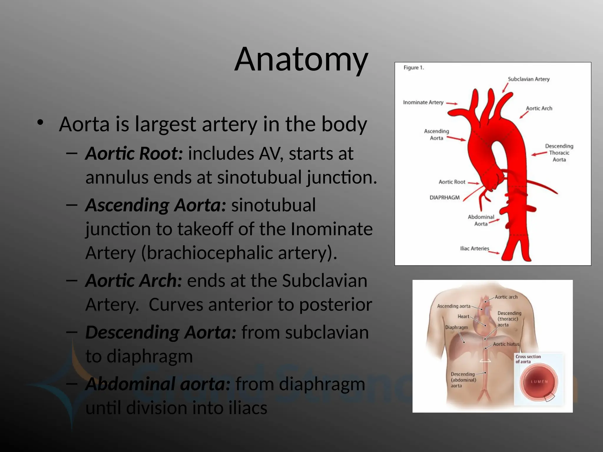 Aortic Dissection and Acute Aortic Syndrome | PPTX