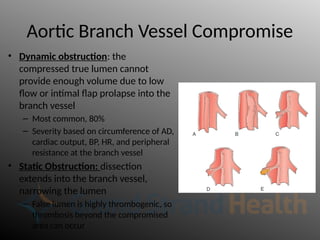 Aortic Dissection and Acute Aortic Syndrome | PPT
