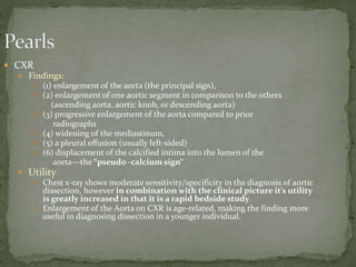 Aortic dissection | PPT