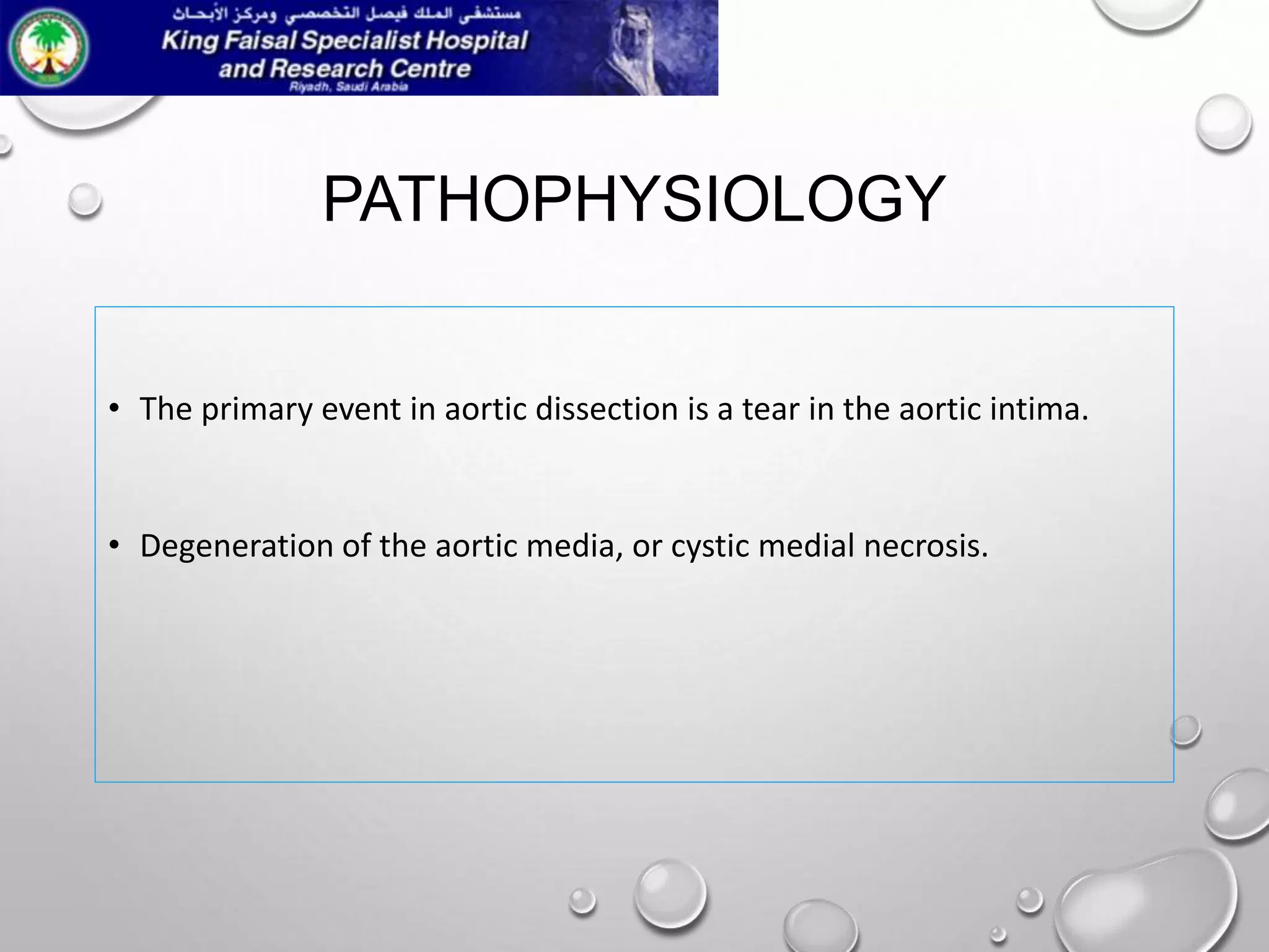 Aortic dissection, pathophysiology, risk, incidence, types and ...