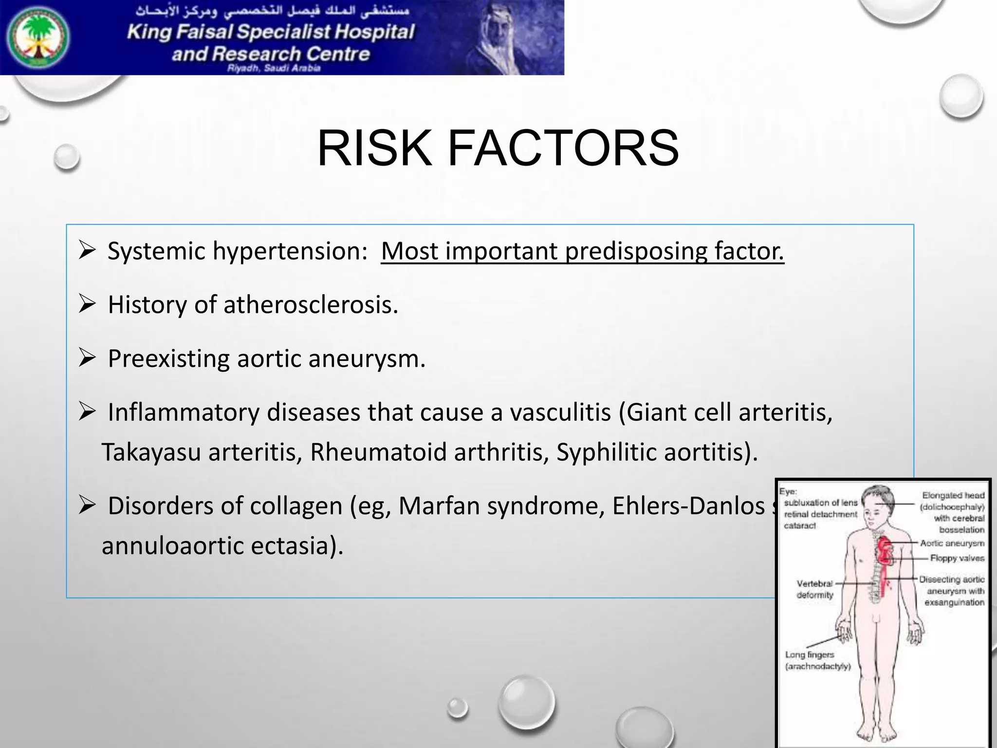 Aortic dissection, pathophysiology, risk, incidence, types and ...