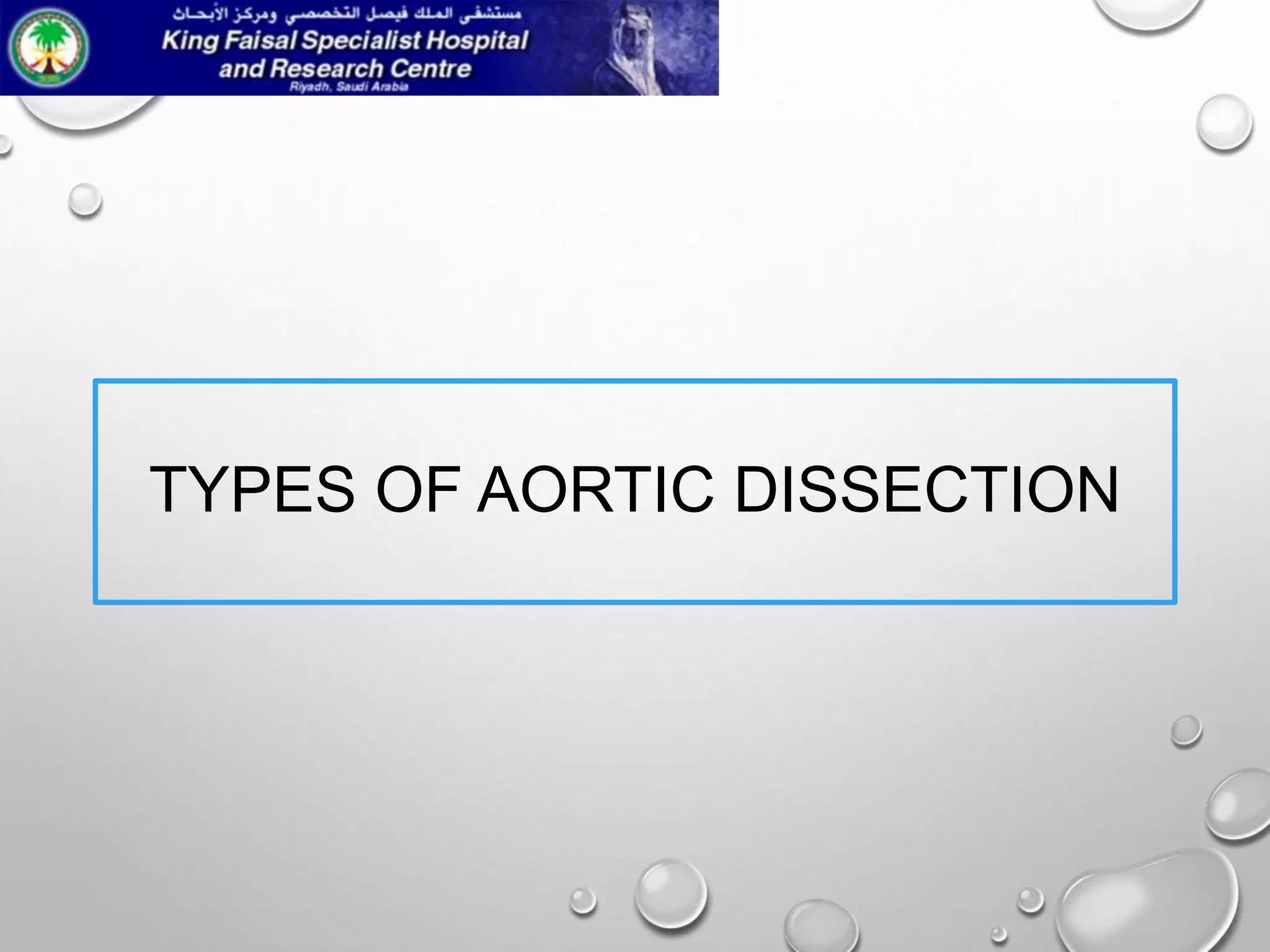 Aortic dissection, pathophysiology, risk, incidence, types and ...