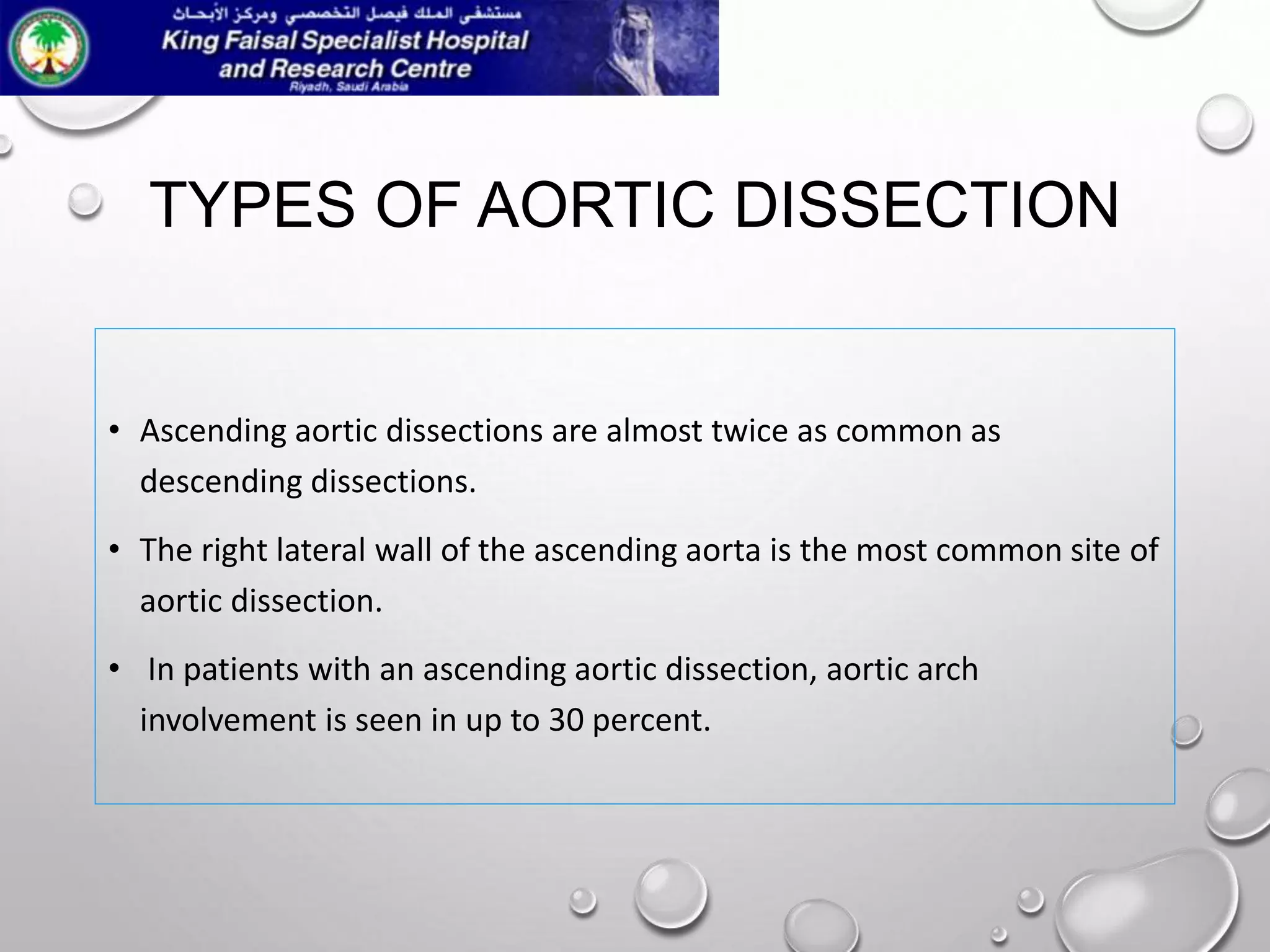 Aortic dissection, pathophysiology, risk, incidence, types and ...