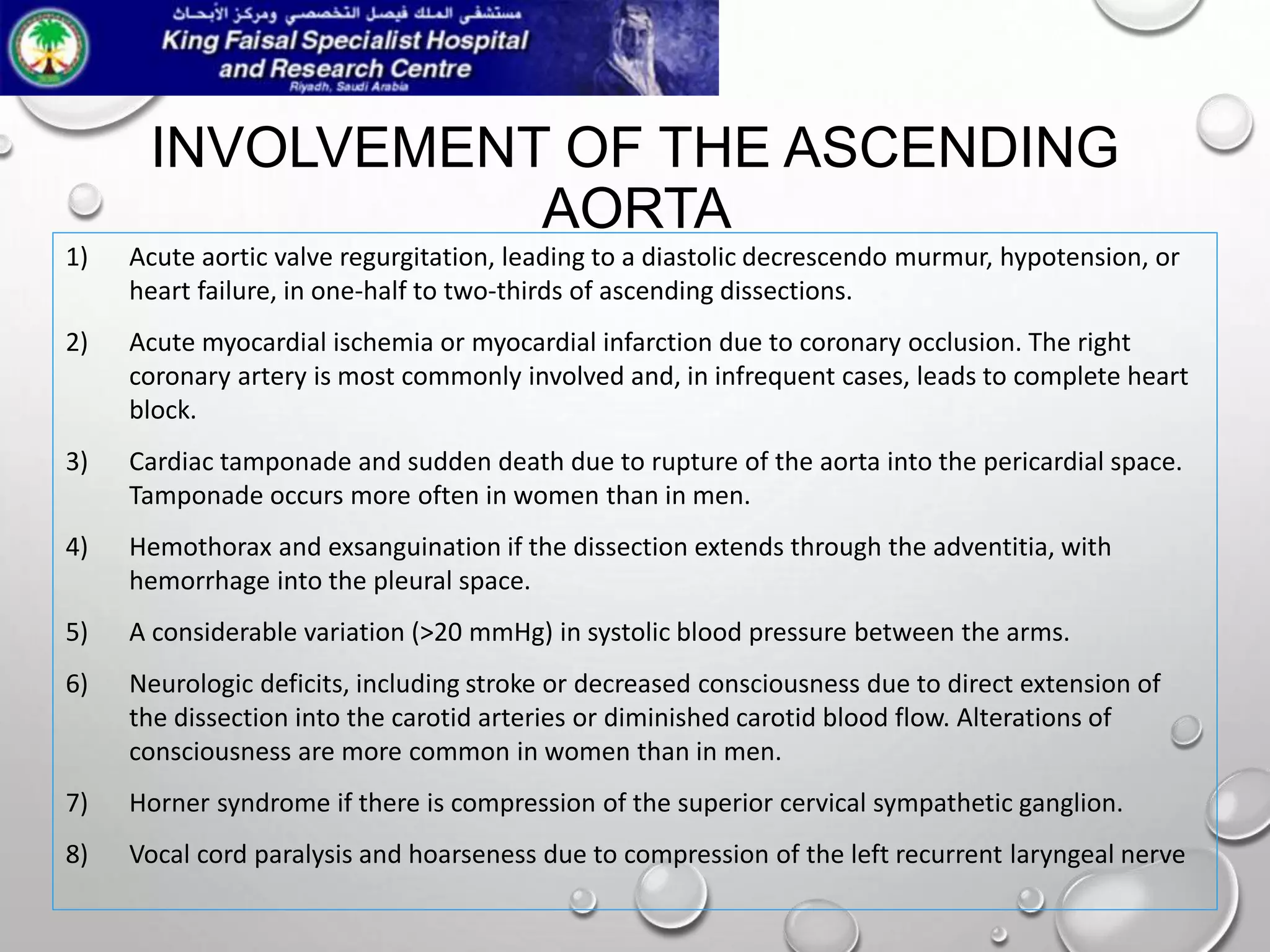 Aortic dissection, pathophysiology, risk, incidence, types and ...