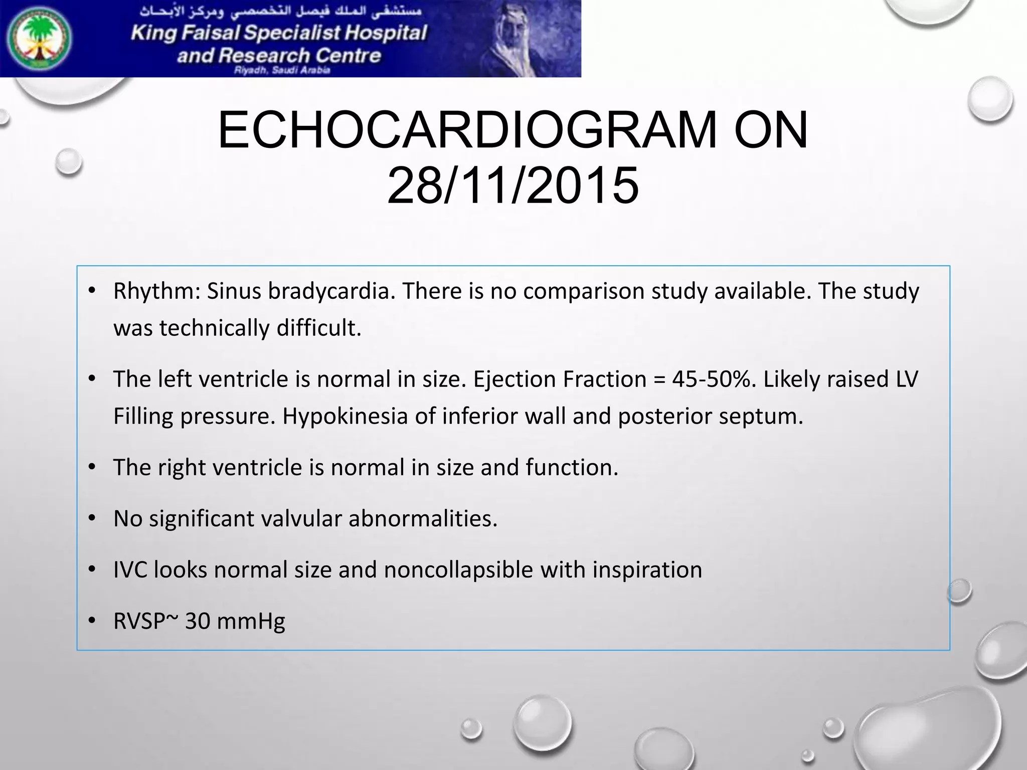 Aortic dissection, pathophysiology, risk, incidence, types and ...