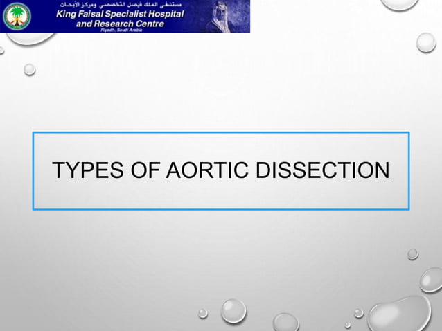 Aortic dissection, pathophysiology, risk, incidence, types and ...