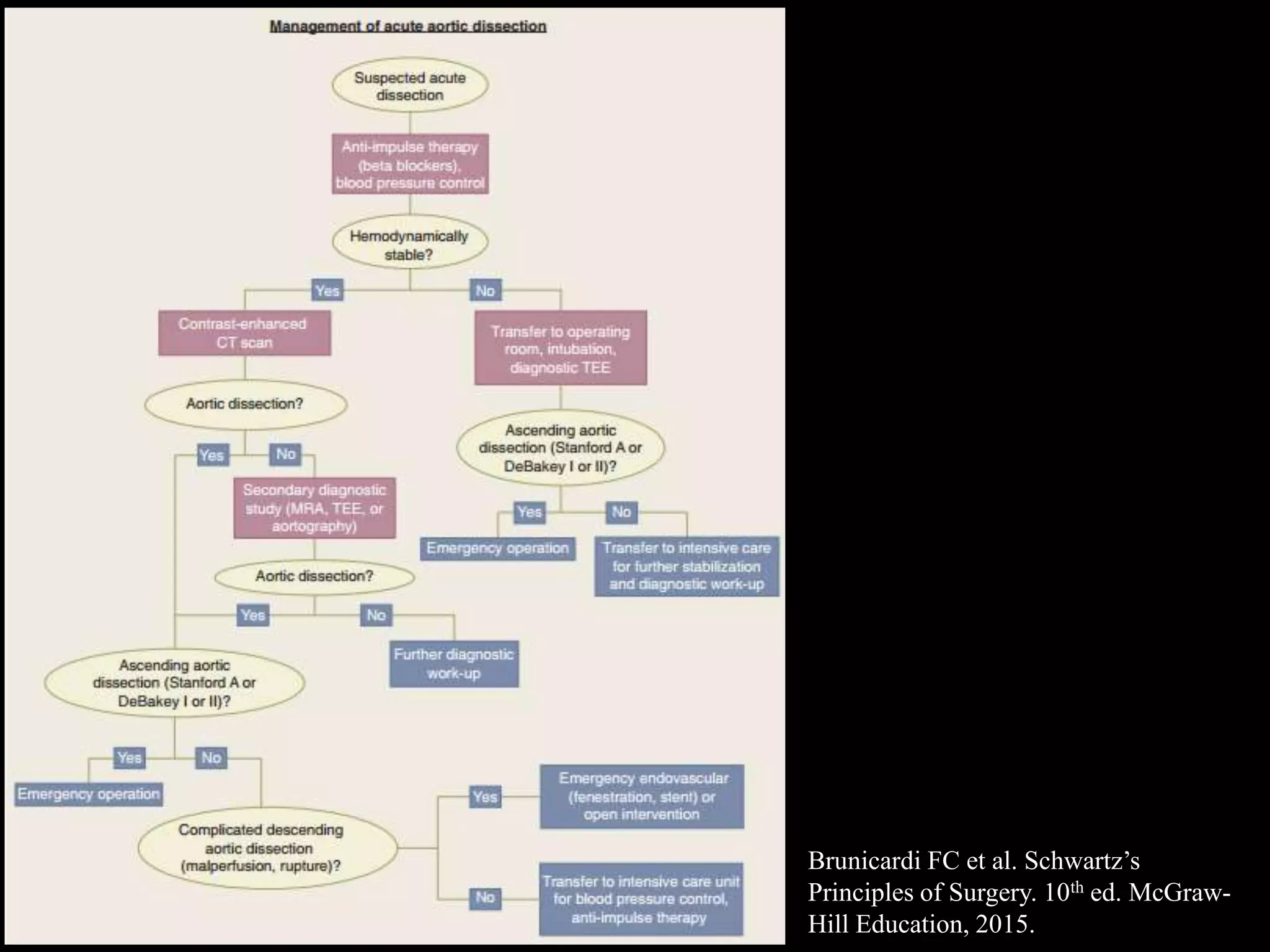 Aortic dissection | PPT