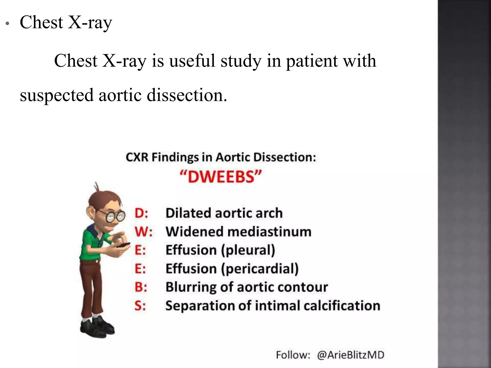 AORTIC DISSECTION | PPTX