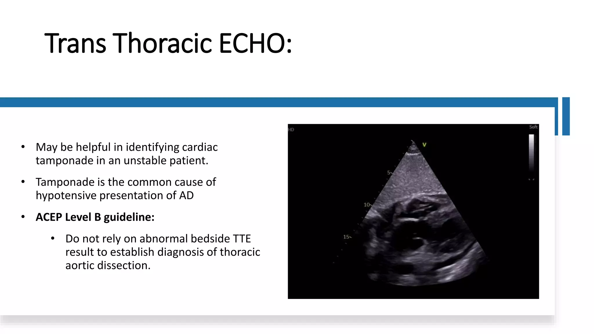 Aortic dissection .pptx