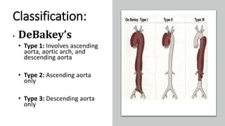 Aortic dissection .pptx