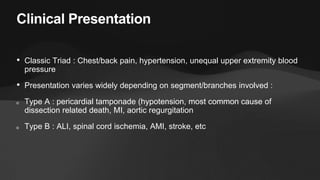 Aortic Dissection.pptx