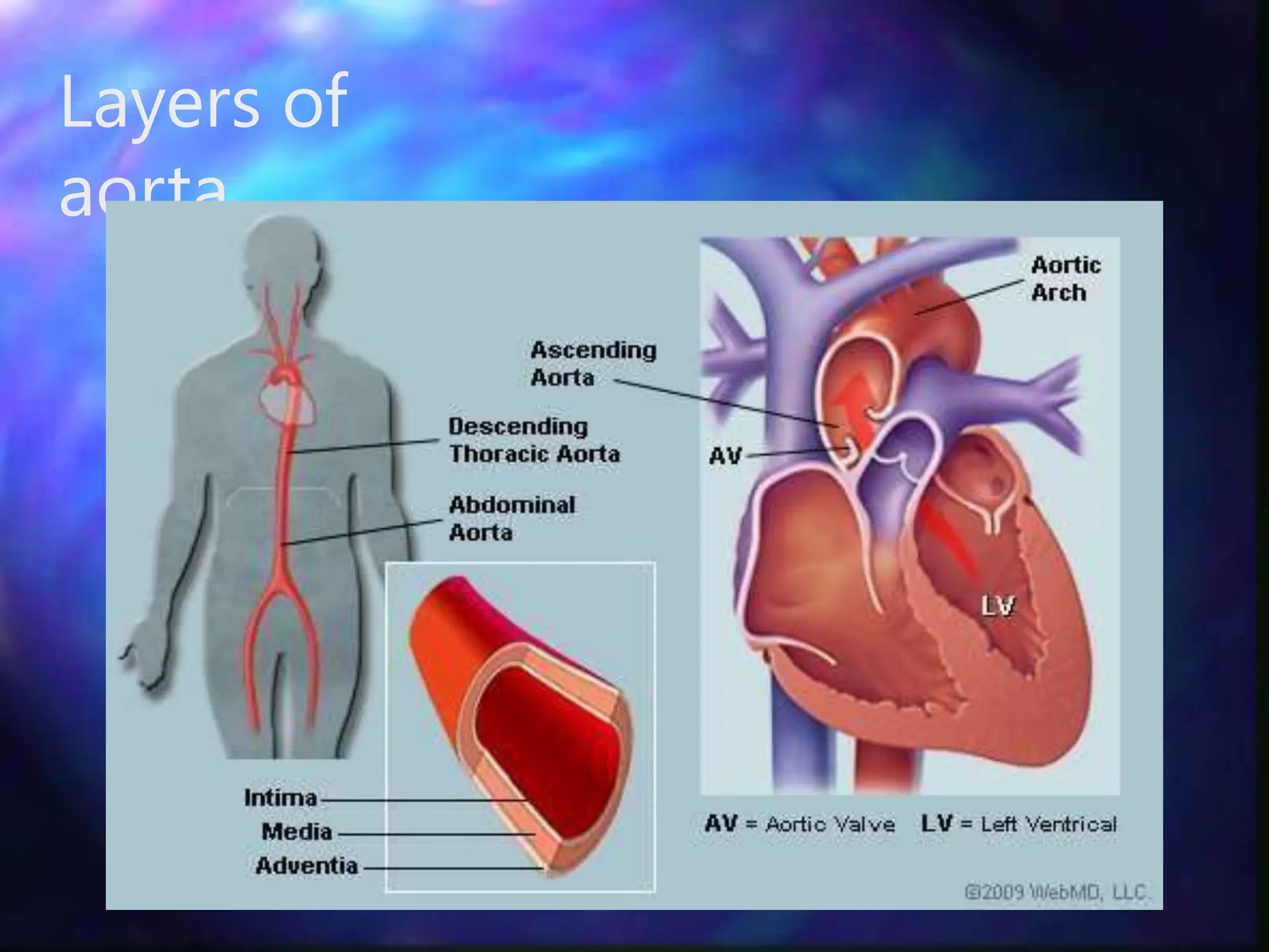 AORTIC DISSECTION and management of aortic dissection | PPTX