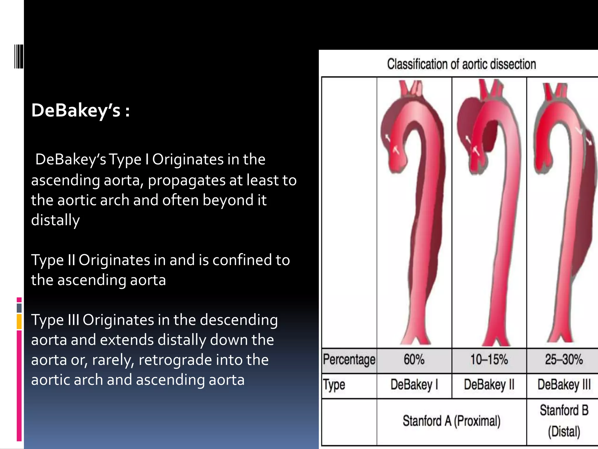 Aortic dissection 01 | PPTX