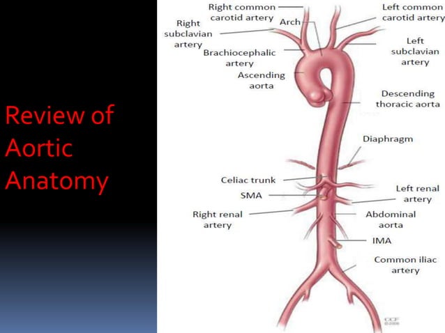 Aortic dissection 01 | PPTX | Heart and Cardiovascular Diseases | Diseases and Conditions