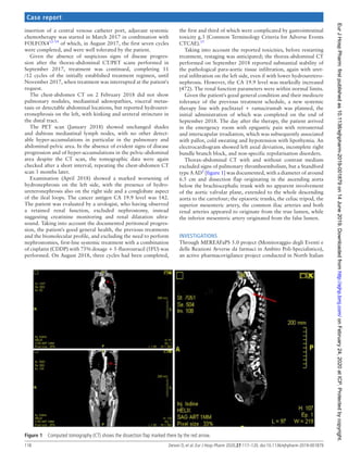 Aortic dissection after ramucirumab infusion dz 2019 | PDF