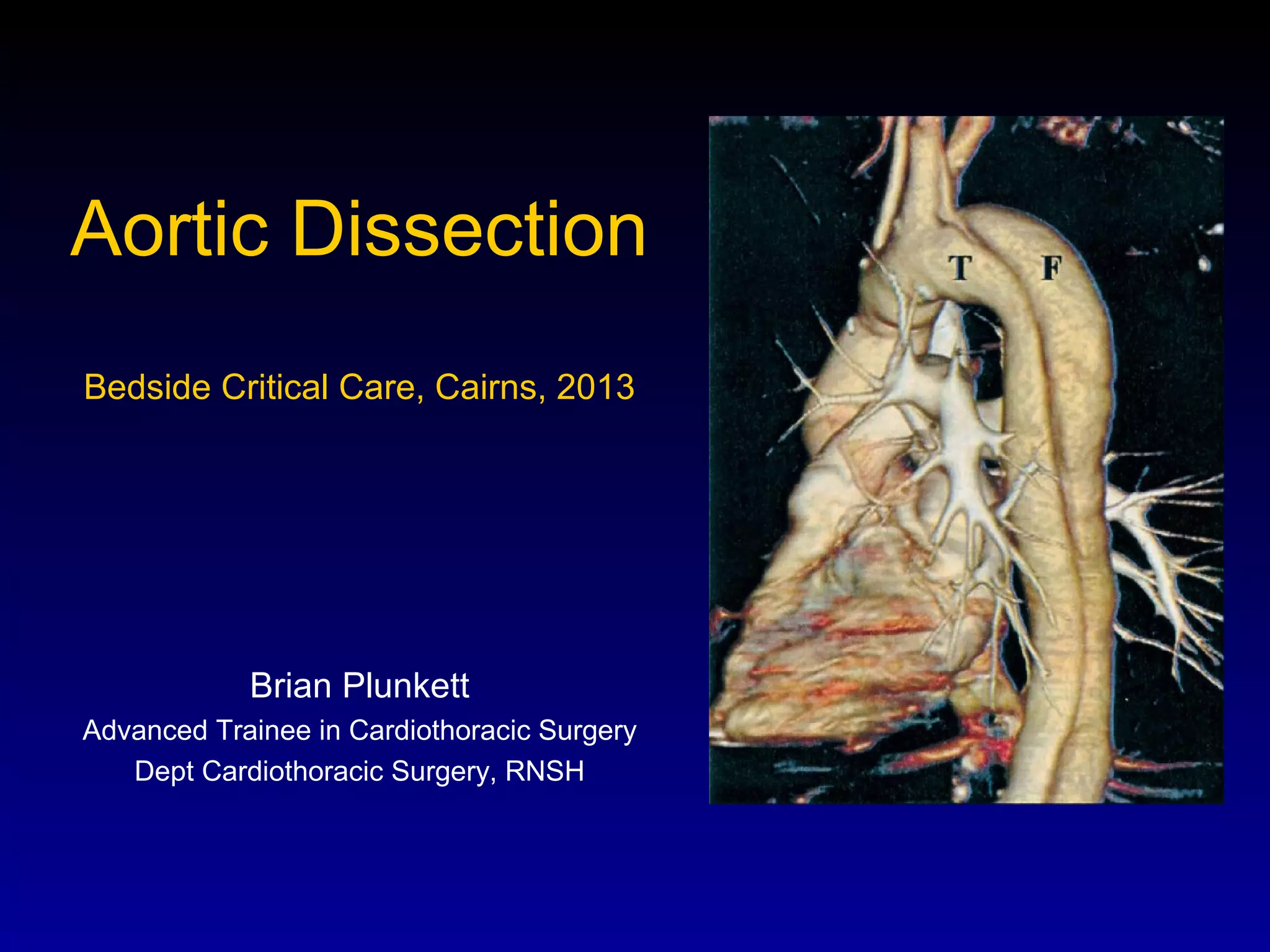 BCC4: Plunkett on Thoracic Aortic Dissection | PPT | Heart and ...