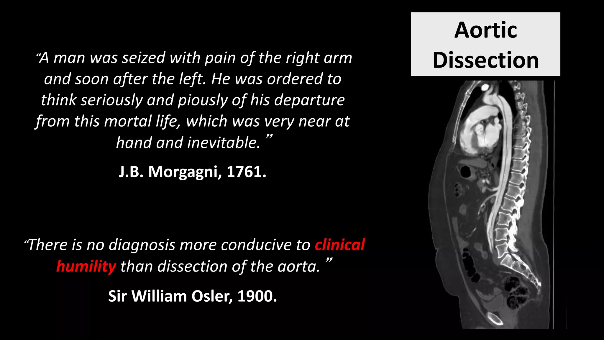 EMGuideWire's Radiology Reading Room: Aortic Dissection | PPTX