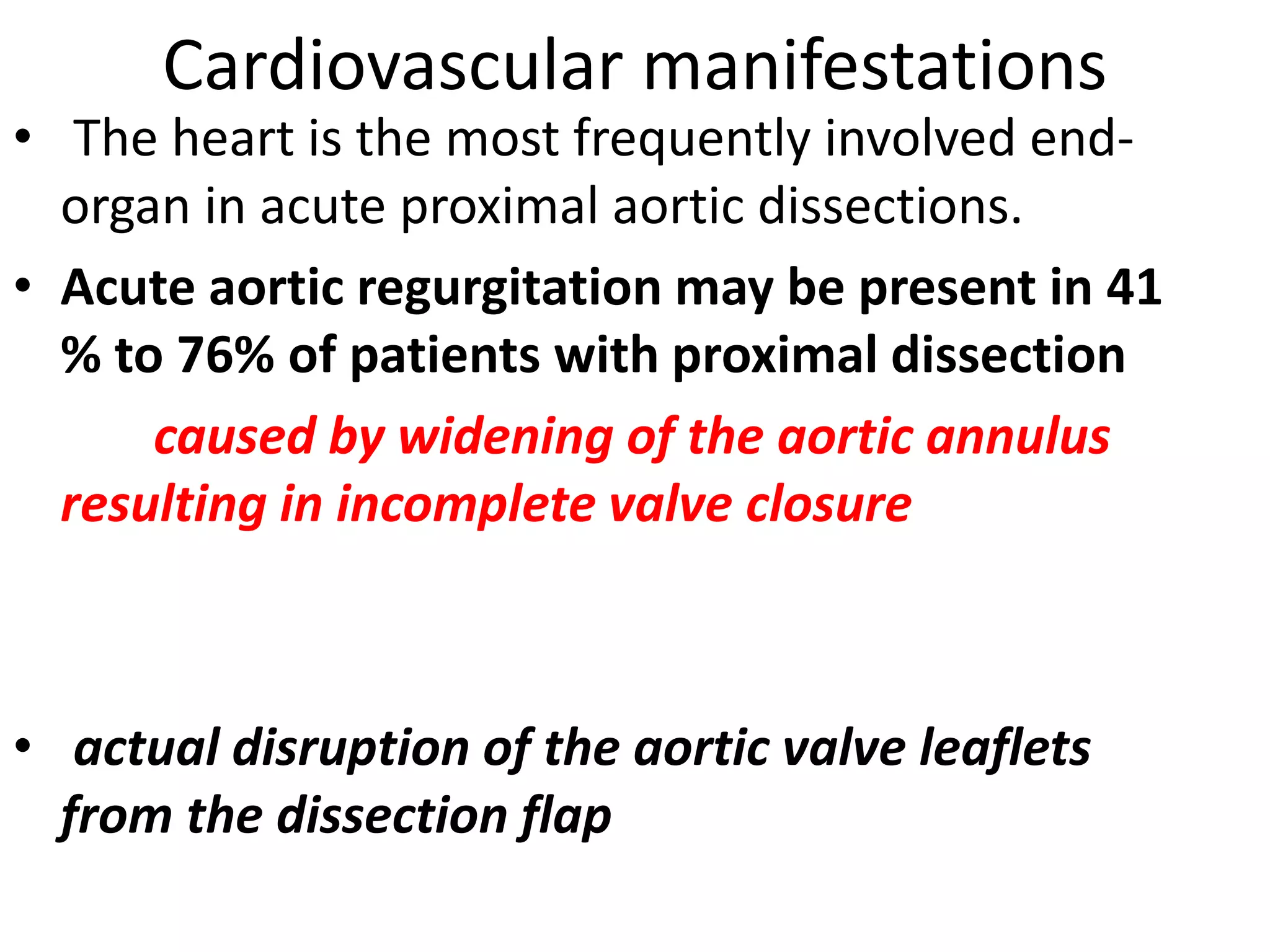 Aortic dissection ppt | PPTX