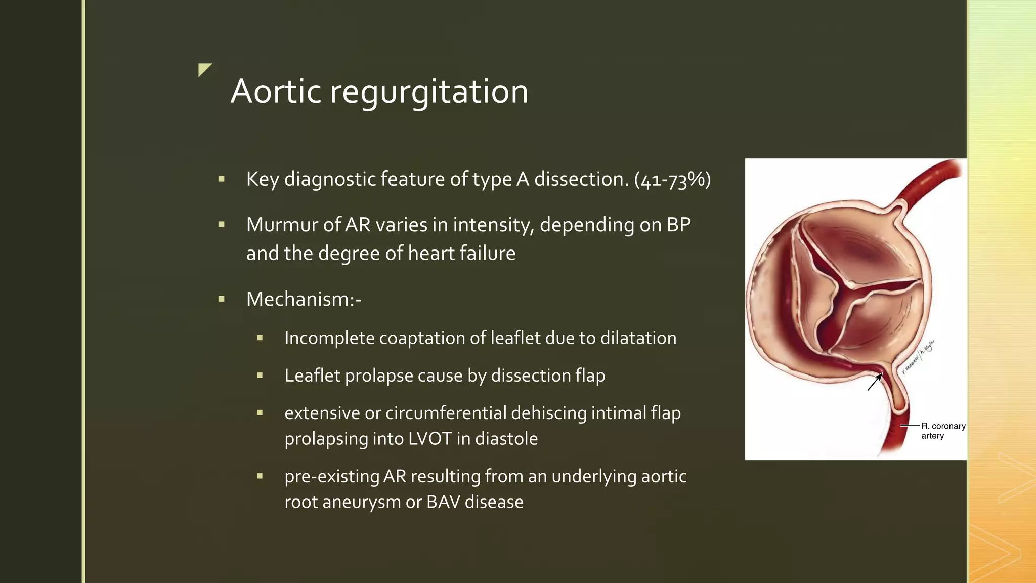 Aortic dissection ppt.pptx