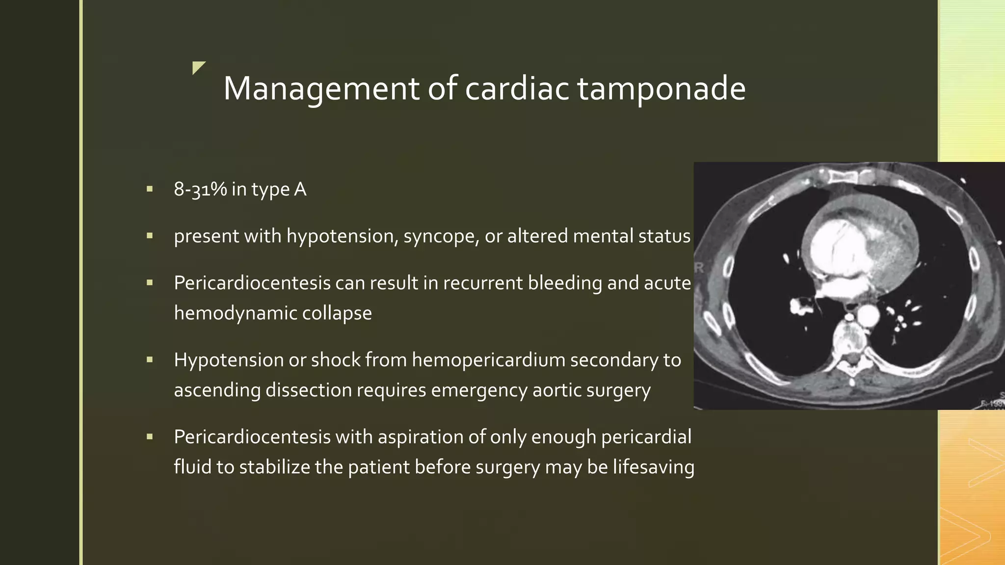 Aortic dissection ppt.pptx