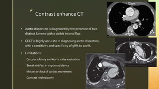 Aortic dissection ppt.pptx
