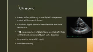 Aortic dissection ppt.pptx