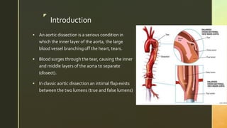 Aortic dissection ppt.pptx