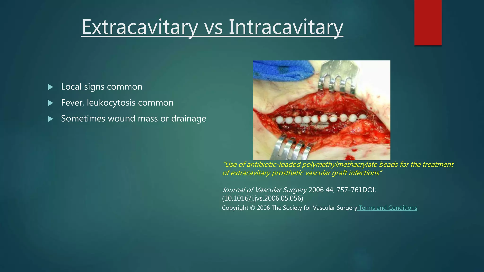 Aortic graft infections 2016-University of Arizona | PPTX