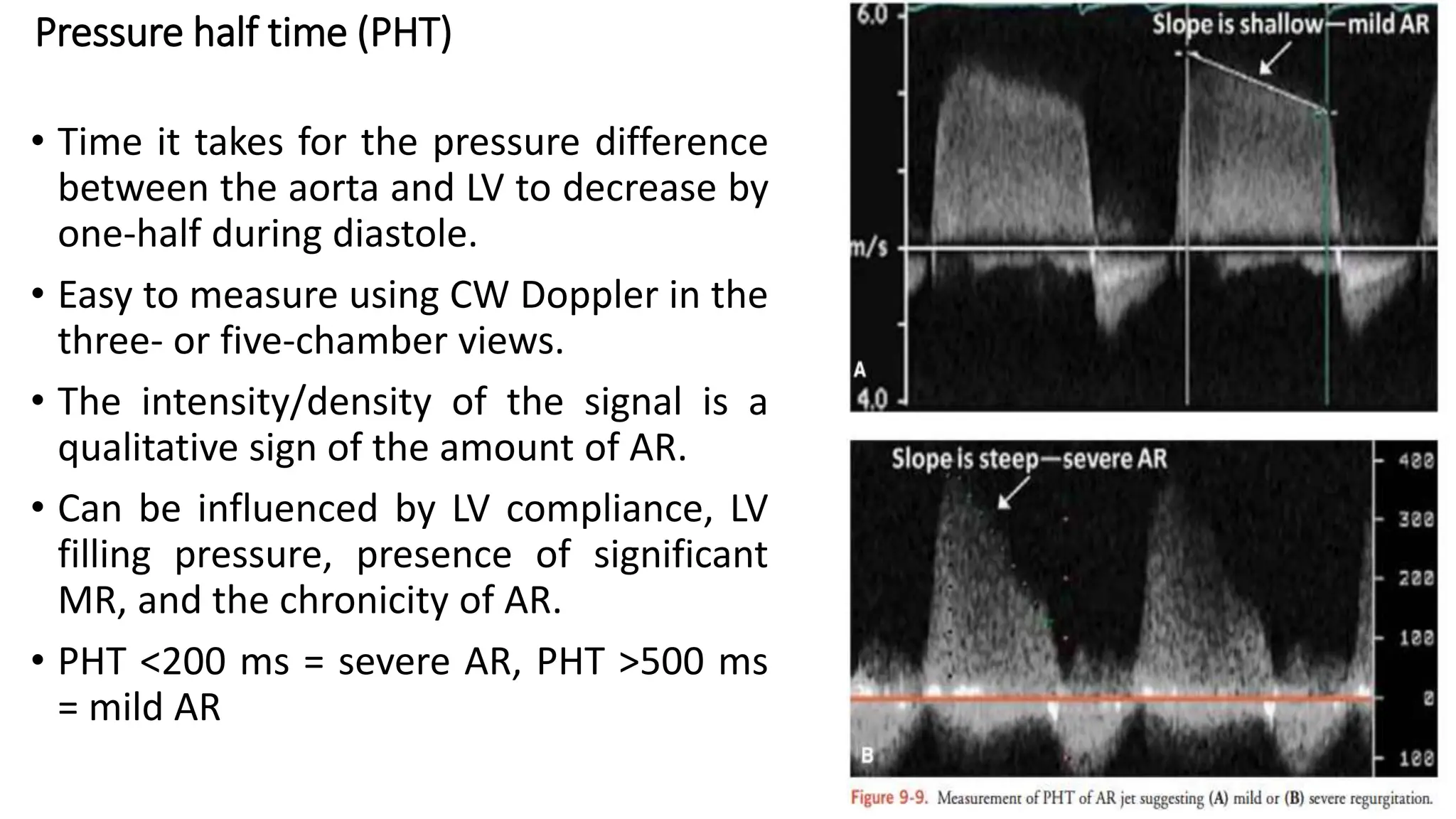 valvular heart diseaseAORTIC REGURGITATION.pptx
