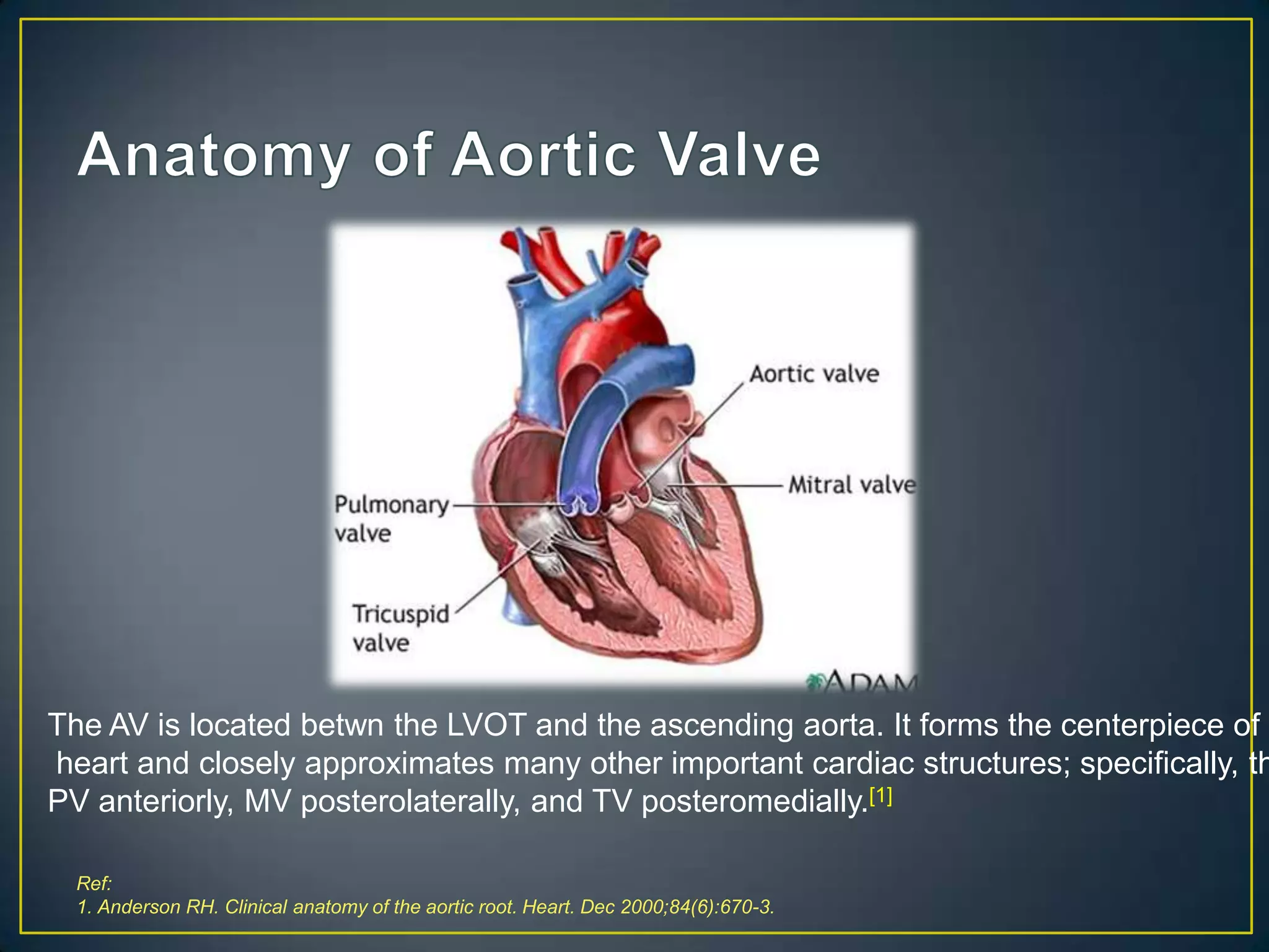 Aortic regurgitation | PPTX