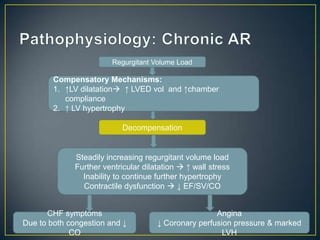 Aortic regurgitation | PPTX