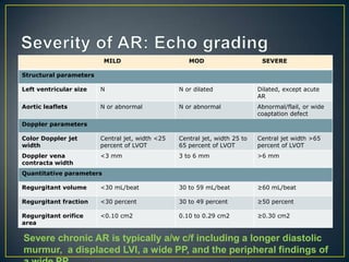 Aortic regurgitation | PPTX
