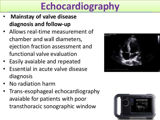 Aortic regurgitation for post graduates